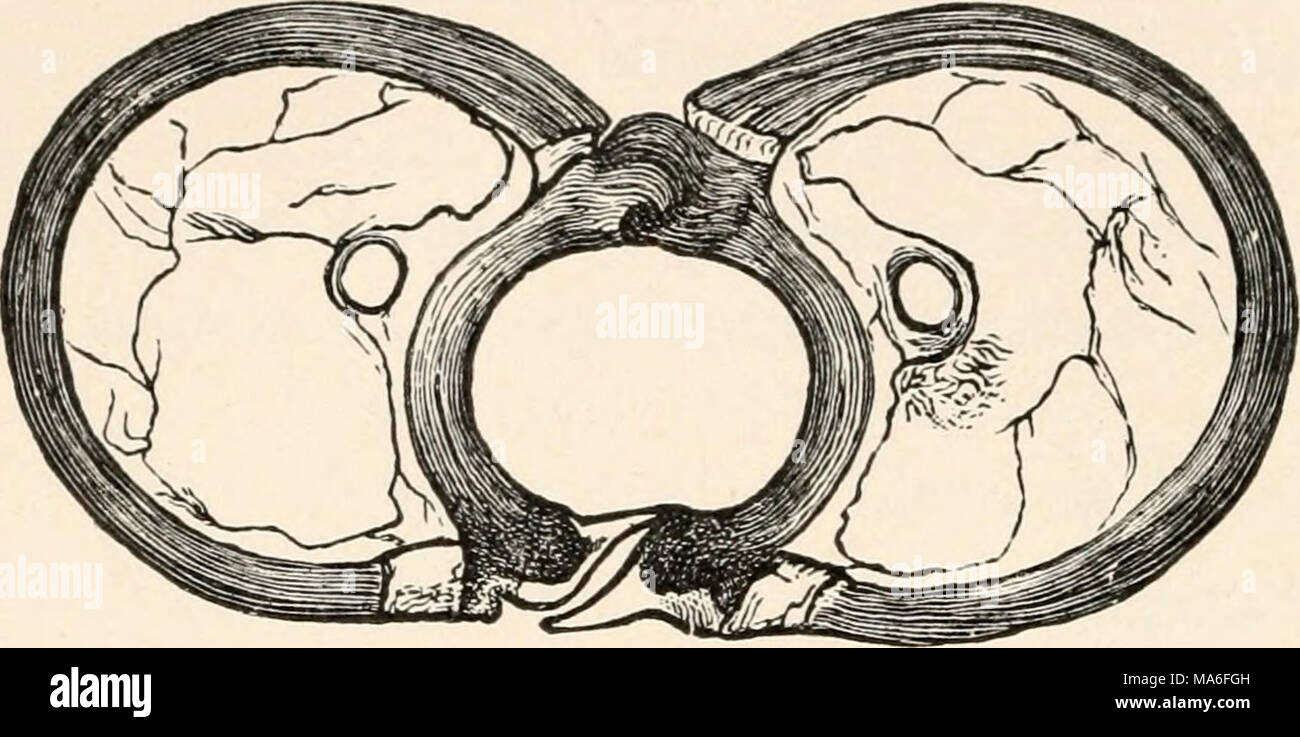Moth Proboscis Anatomy