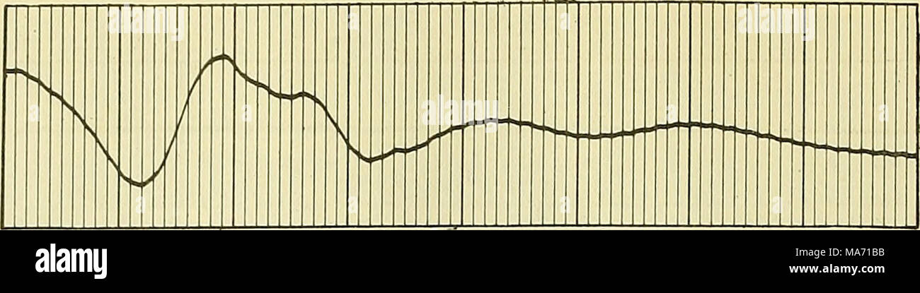 Effects Of Turbulence Stimulators On The Boundary Layer And Resistance Of A Ship Model As