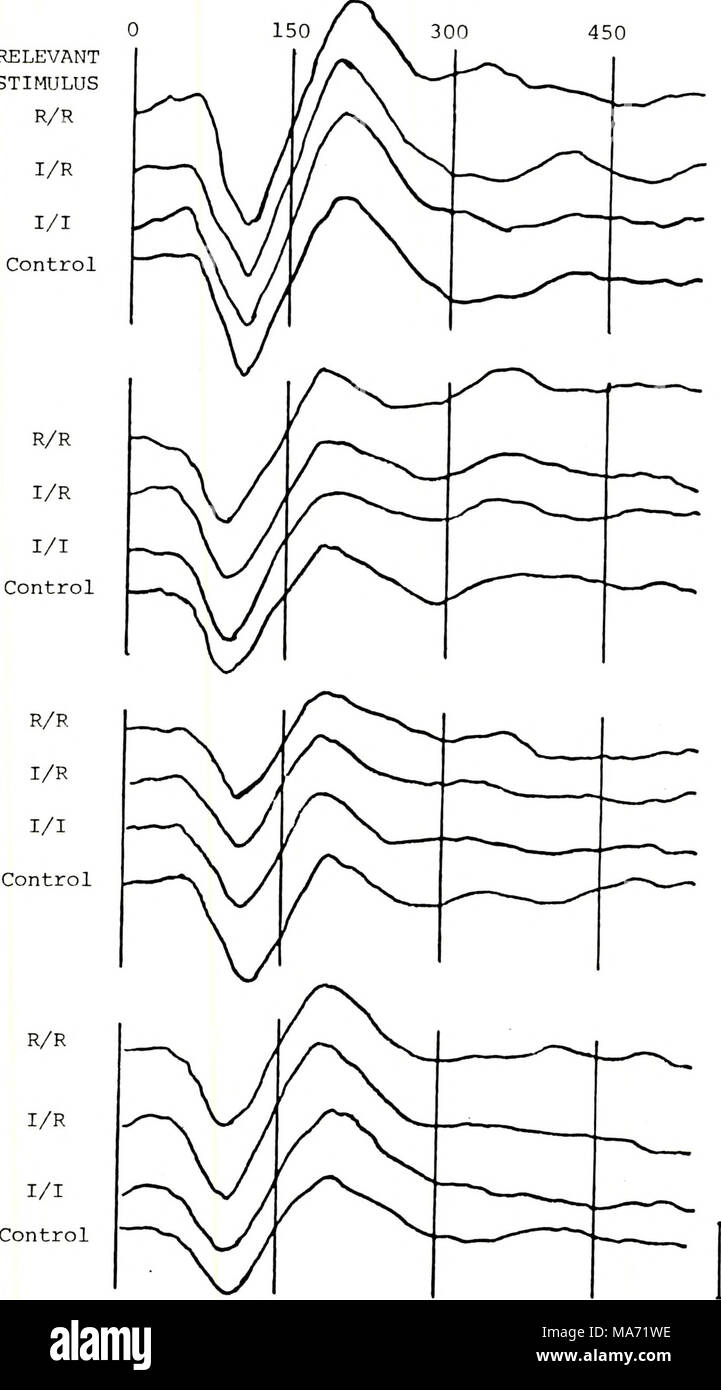 Auditory evoked potentials hi-res stock photography and images - Alamy