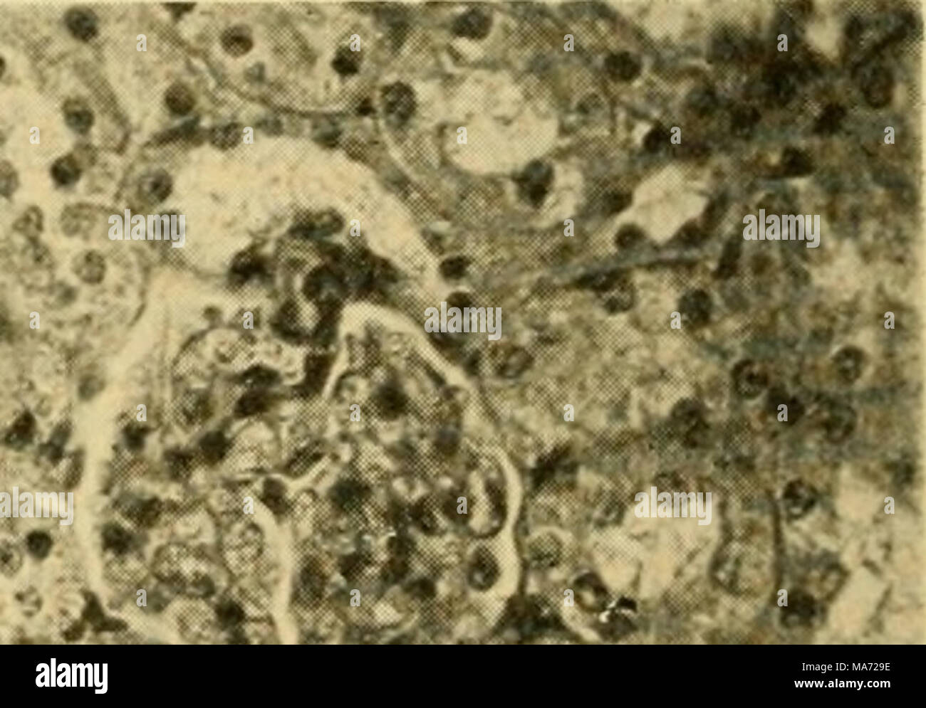 . The effects of inanition and malnutrition upon growth and structure ...
