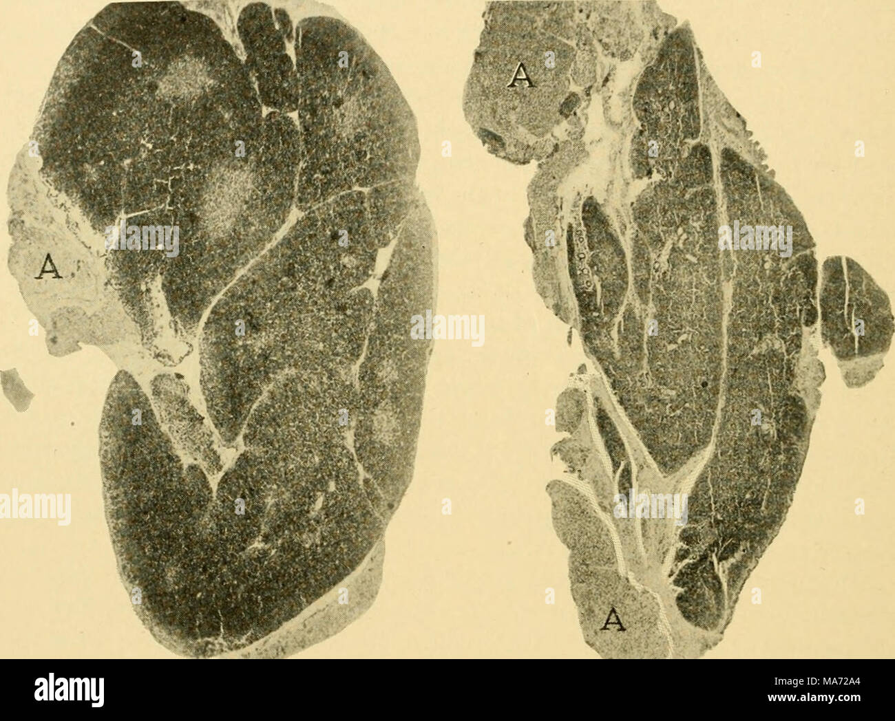 . The effects of inanition and malnutrition upon growth and structure ...