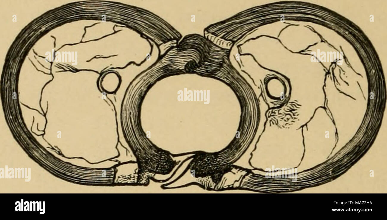 . Elementary entomology . Fig. 17. Cross section of proboscis of cotton ...