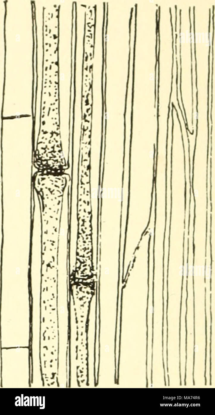 Phloem longitudinal section hi-res stock photography and images - Alamy