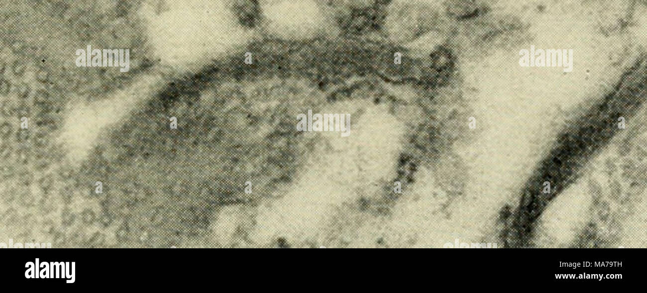 Electron microscopic structure protozoa hi-res stock photography and ...