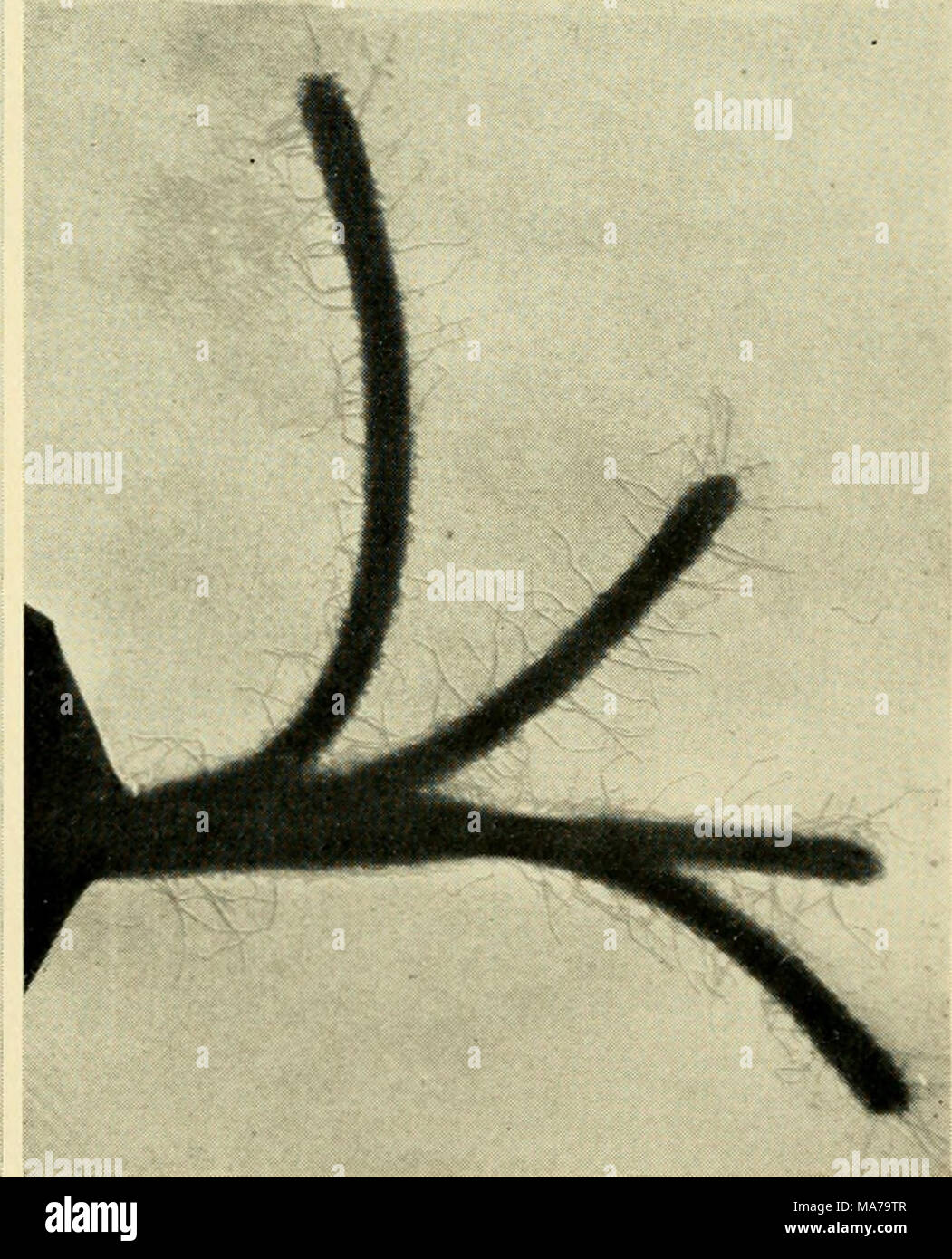 Electron microscopic structure protozoa hi-res stock photography and ...