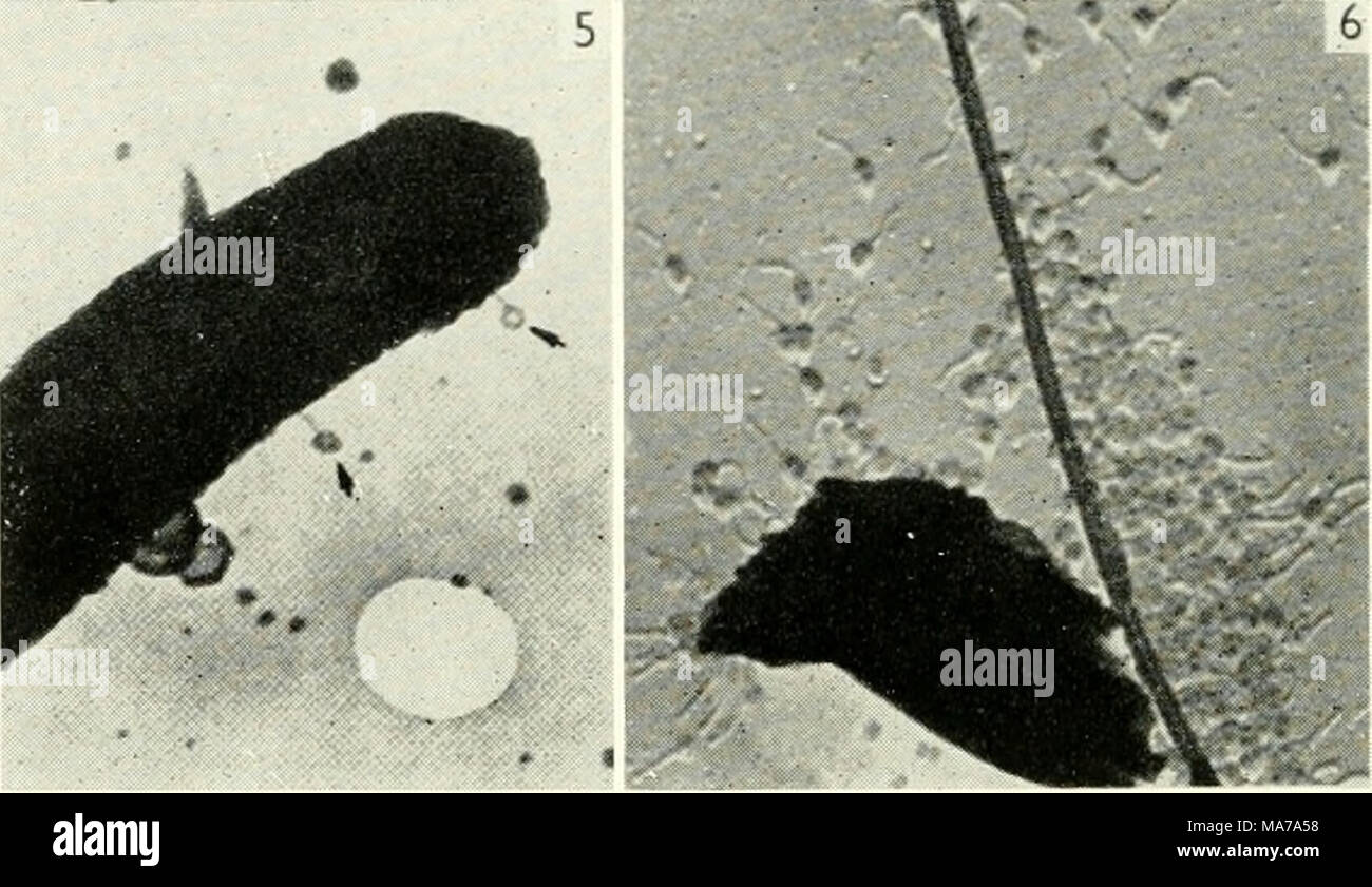 Aerogenes hi-res stock photography and images - Alamy