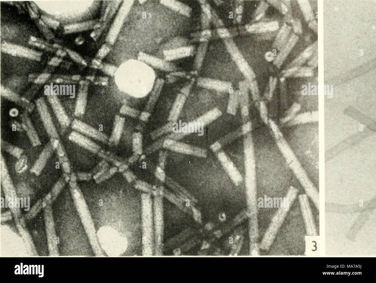 Tmv hi-res stock photography and images - Alamy