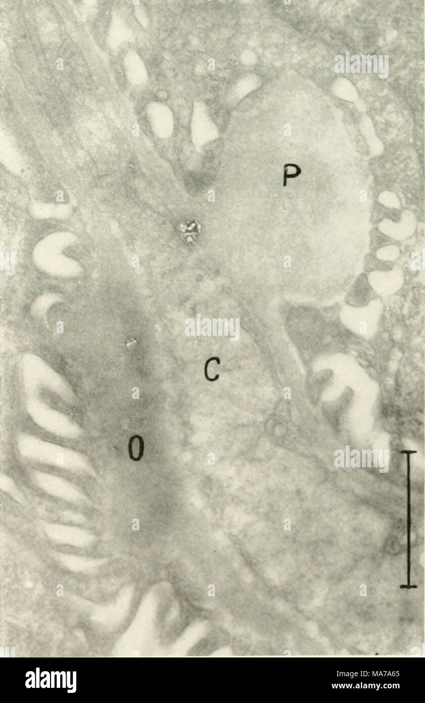 Glomerular Capillary Wall Hi res Stock Photography And Images Alamy glomerular-capillary-wall-hi-res-stock-photography-and-images-alamy