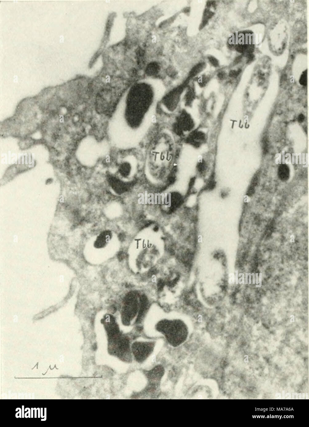 Vacuoles hi-res stock photography and images - Alamy