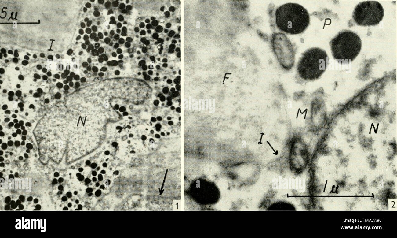 Cell nucleus electron microscopy hi-res stock photography and images ...