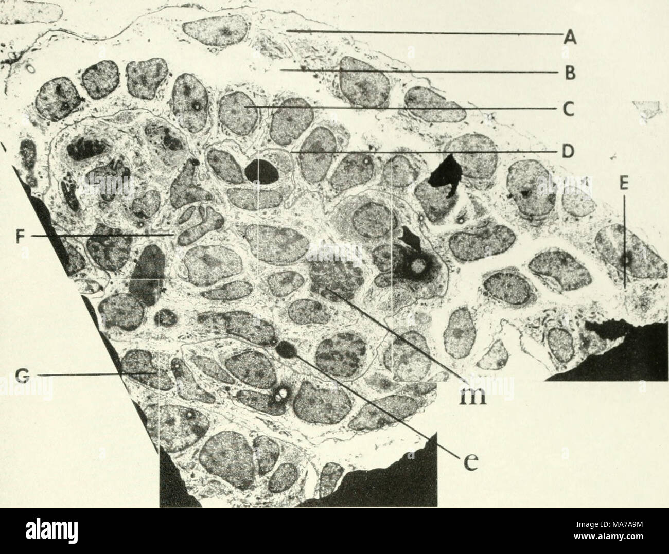 Visceral epithelium hi-res stock photography and images - Alamy