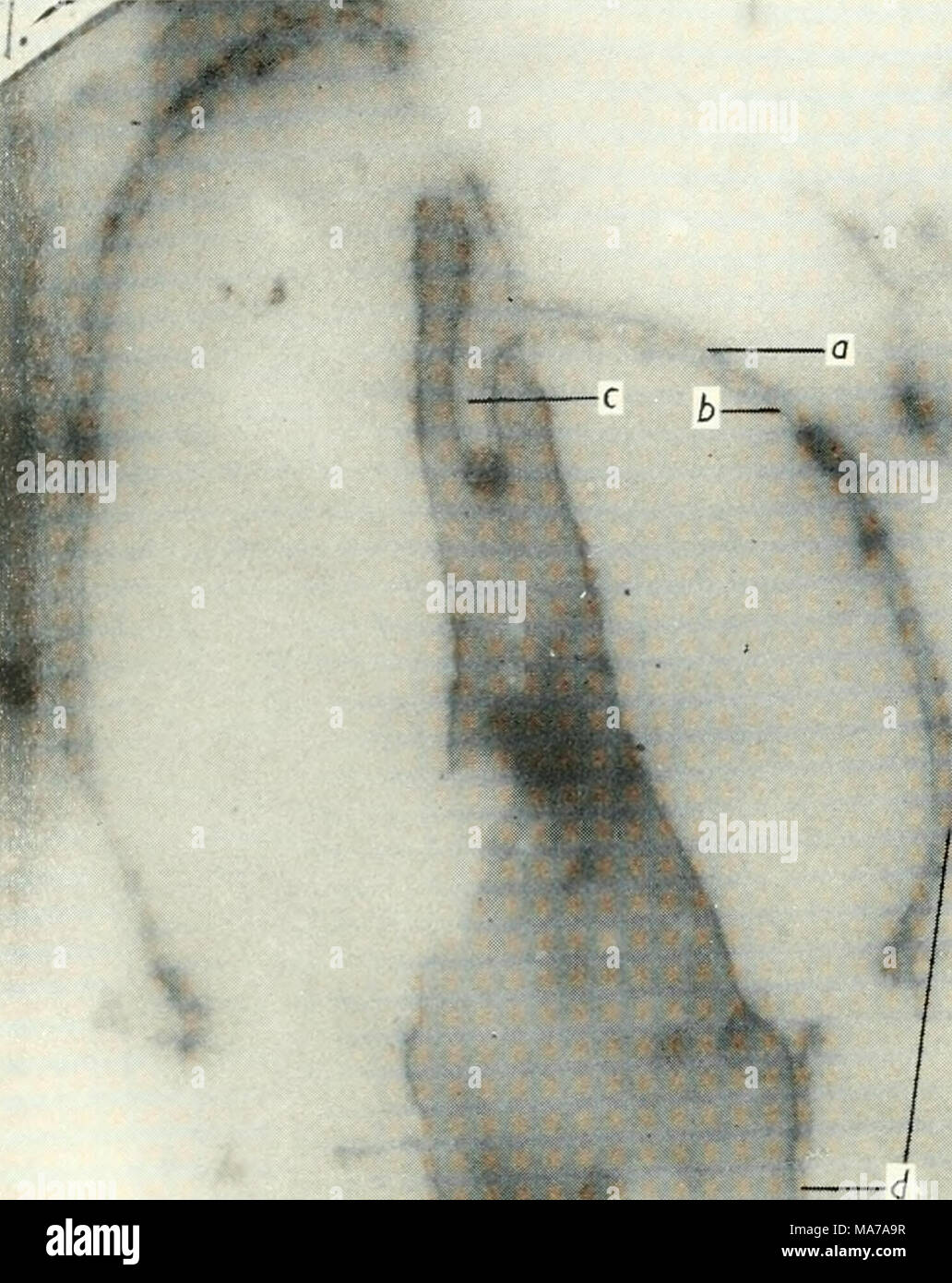 . Electron microscopy; proceedings of the Stockholm Conference ...