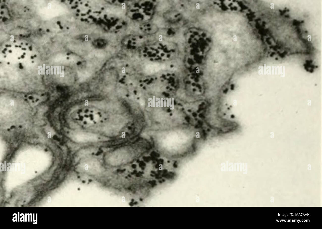 Colloidal gold particles hi-res stock photography and images - Alamy