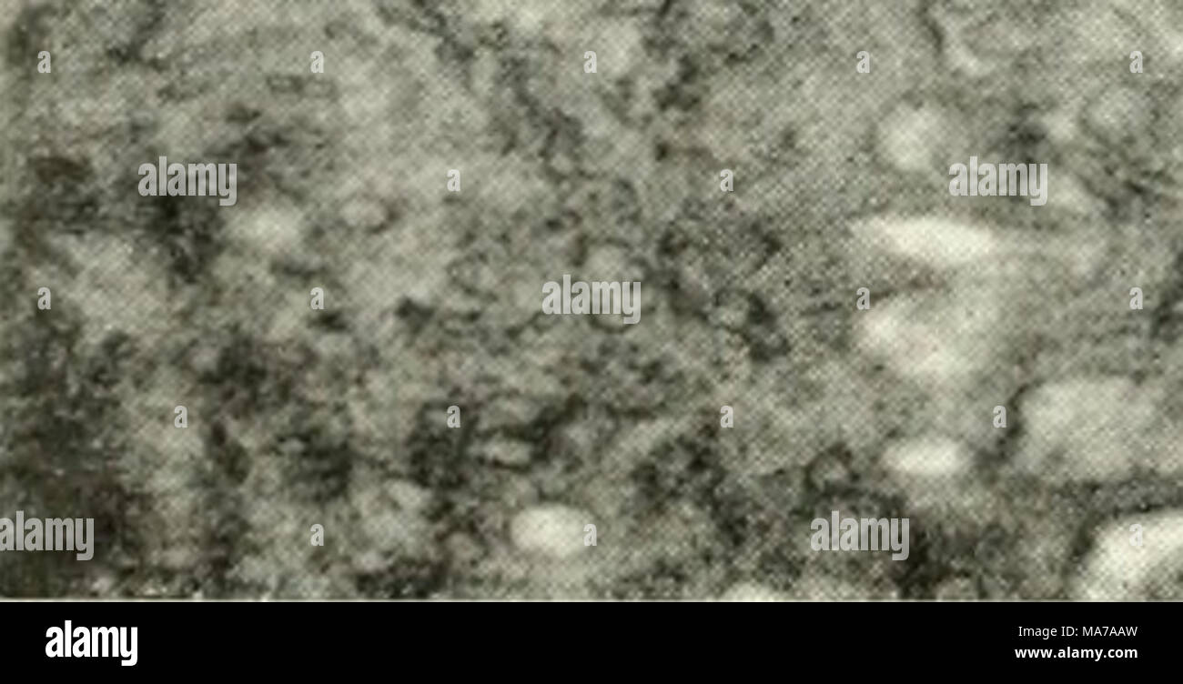 Perisinusoidal cell hi-res stock photography and images - Alamy