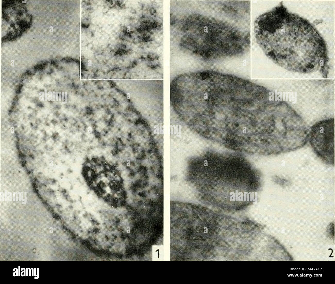 Lysosome Electron Micrograph