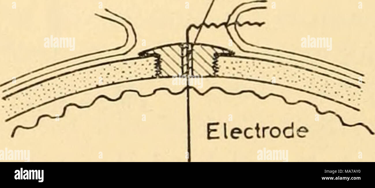 . Electronic apparatus for biological research . Figure 36.2 Fixation ...
