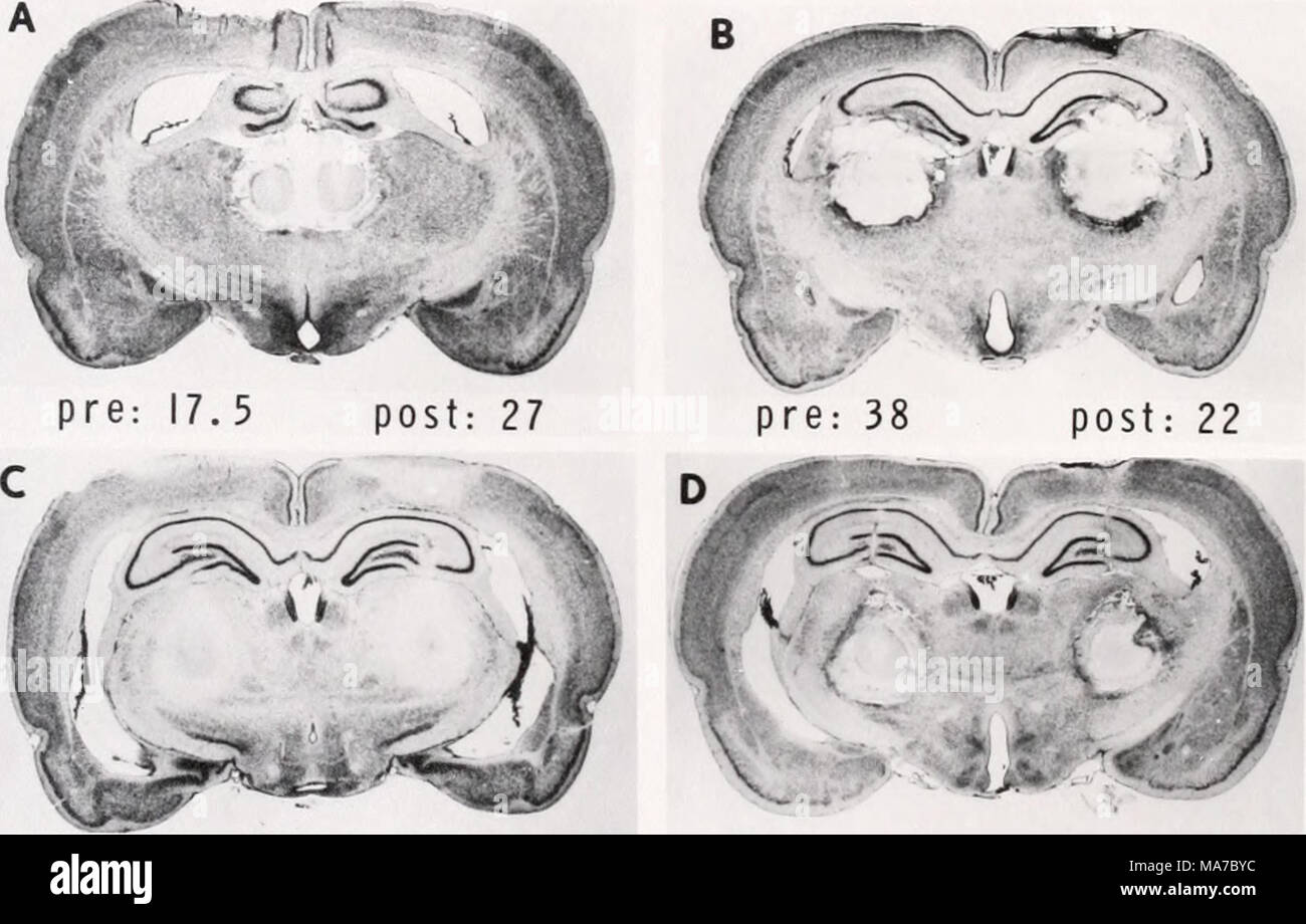 . An electroencephalographic and neuroanatomical analysis of the septal ...