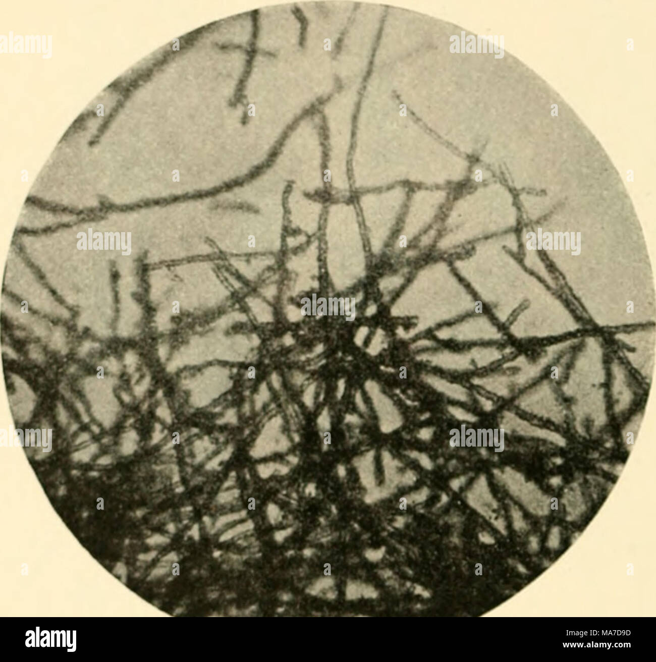 Aspergillus niger hi-res stock photography and images - Alamy