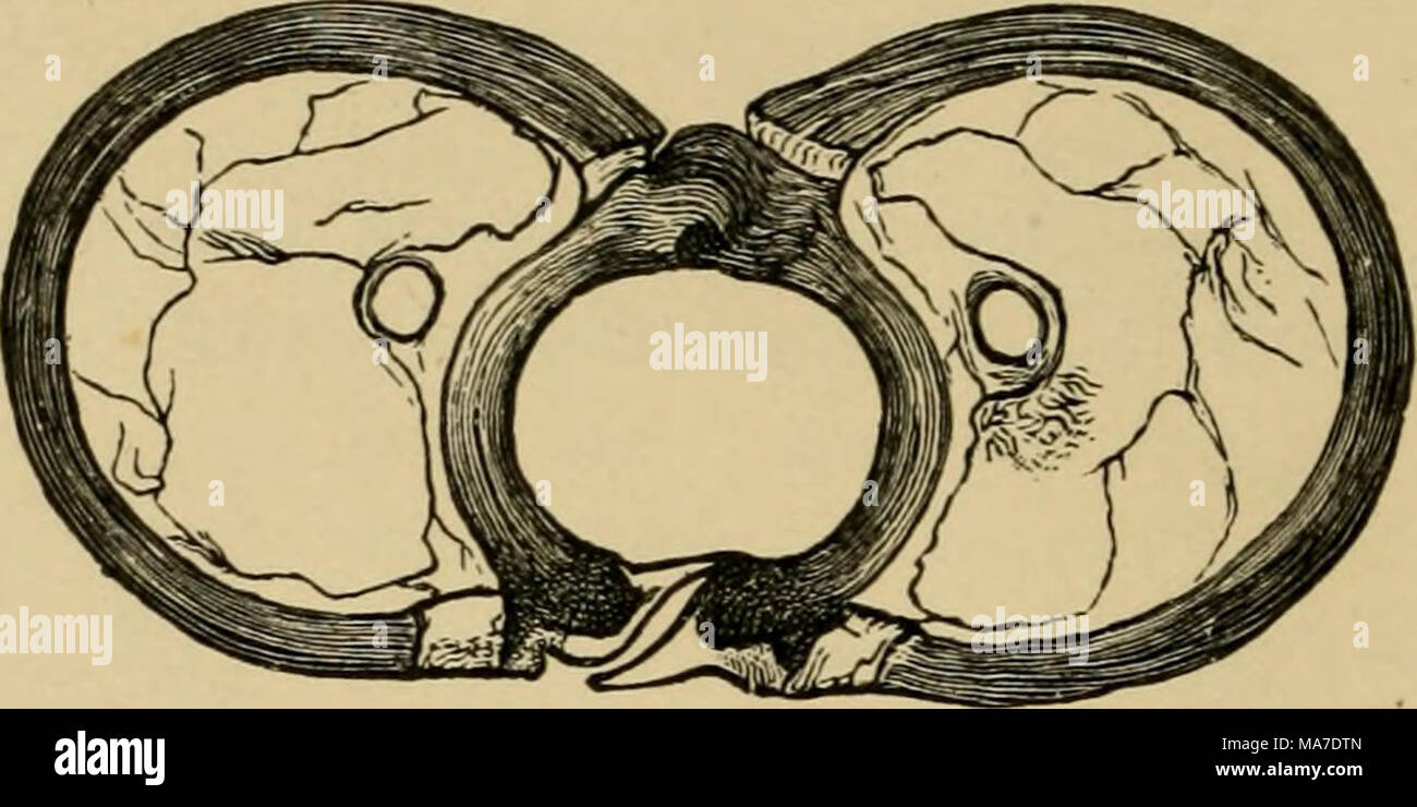 . Elementary entomology . Fig. 17. Cross section of proboscis of cotton ...