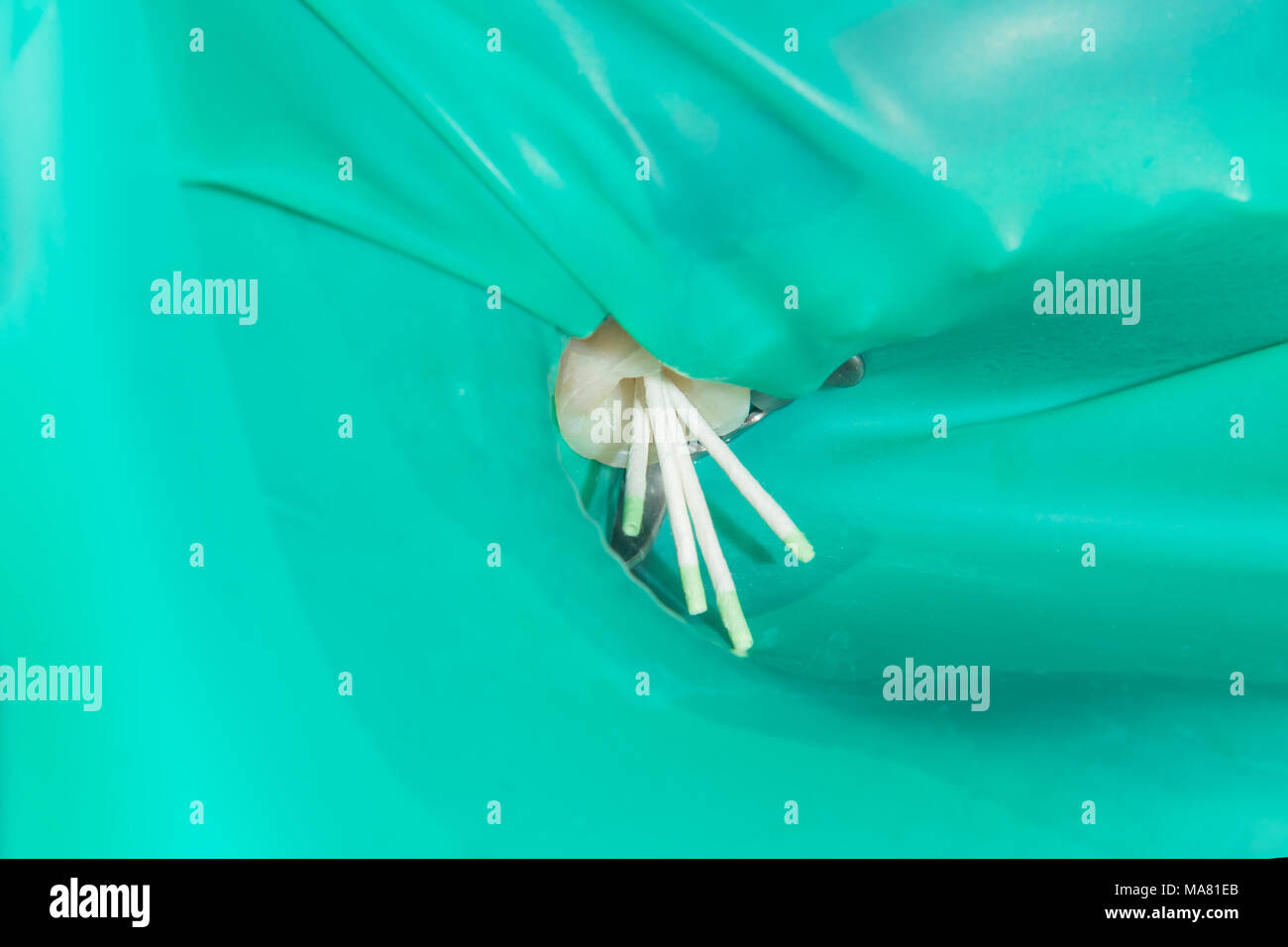 Sealing tooth hi-res stock photography and images - Alamy