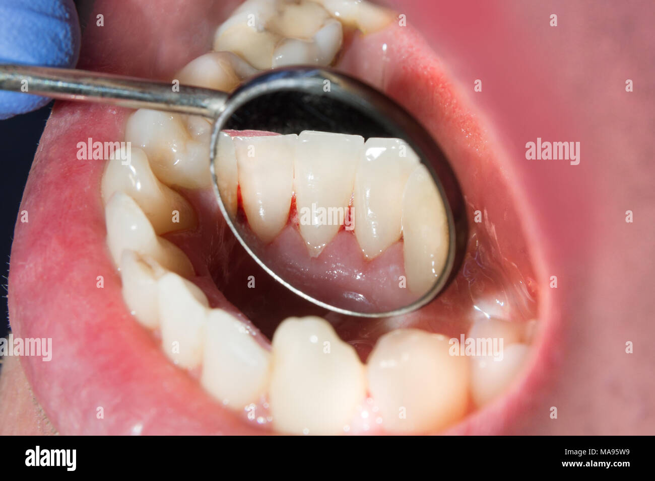 Harm teeth hi-res stock photography and images - Alamy
