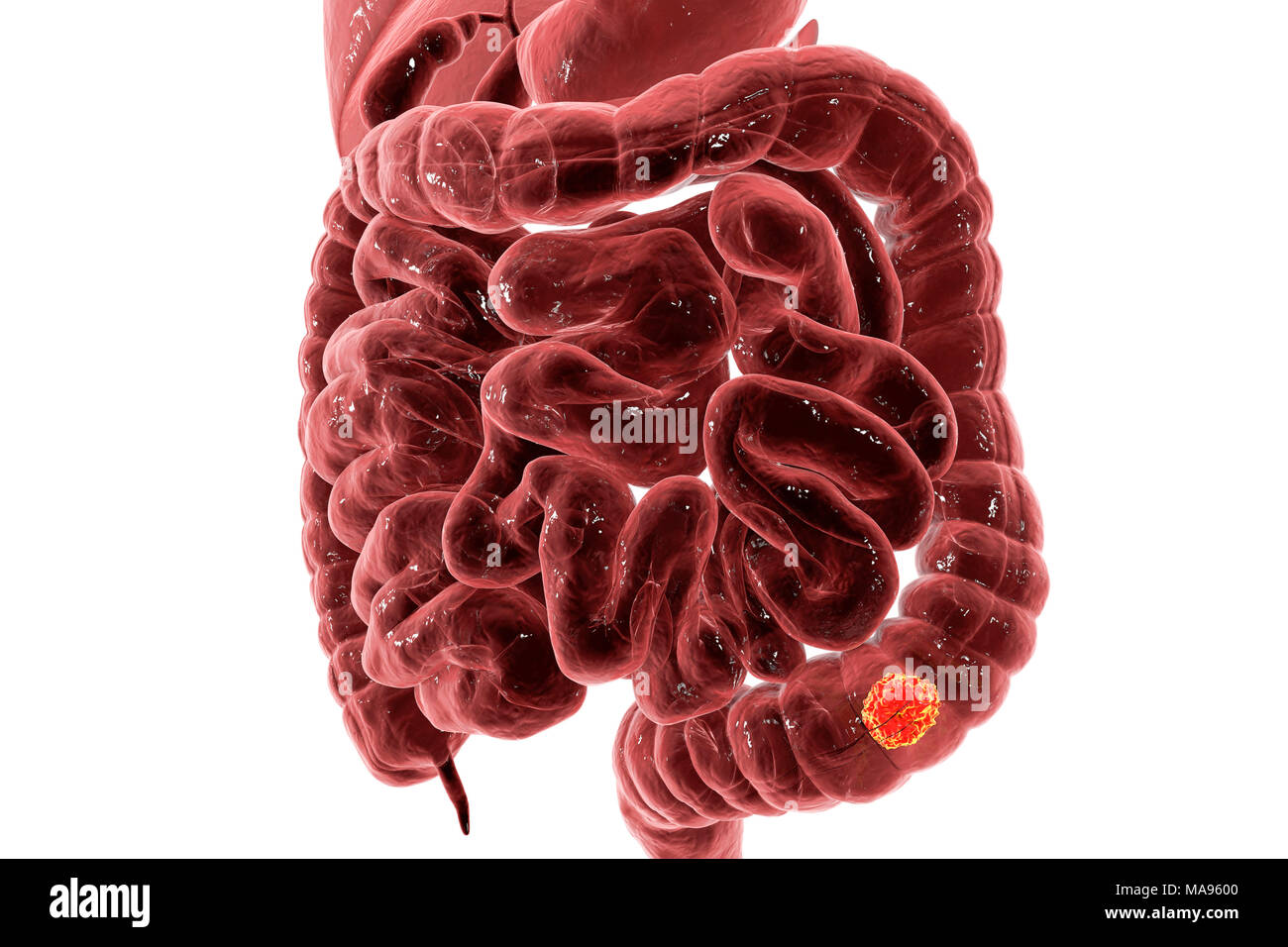 Male colon hi-res stock photography and images - Alamy
