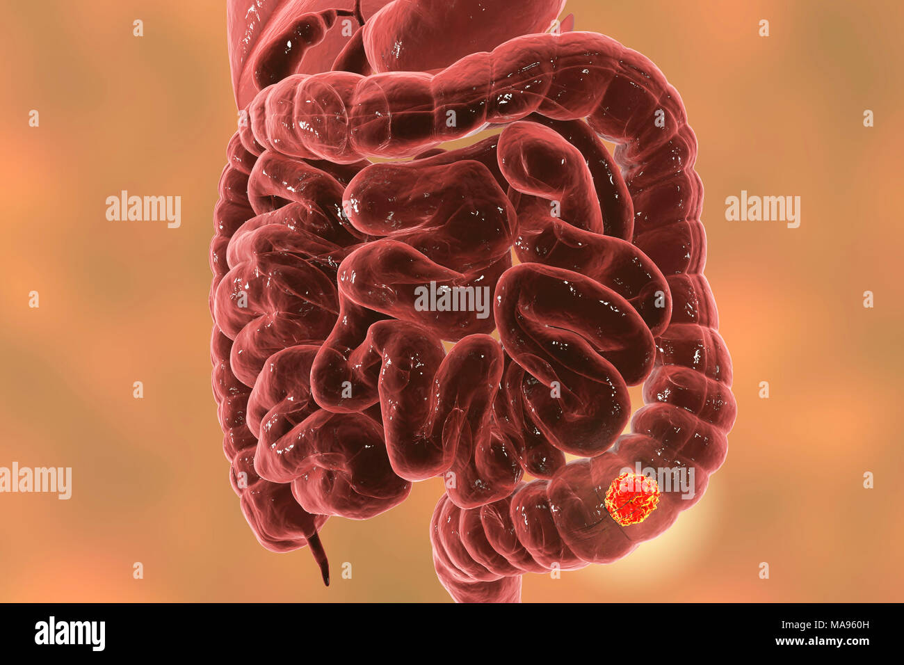 Male colon hi-res stock photography and images - Alamy