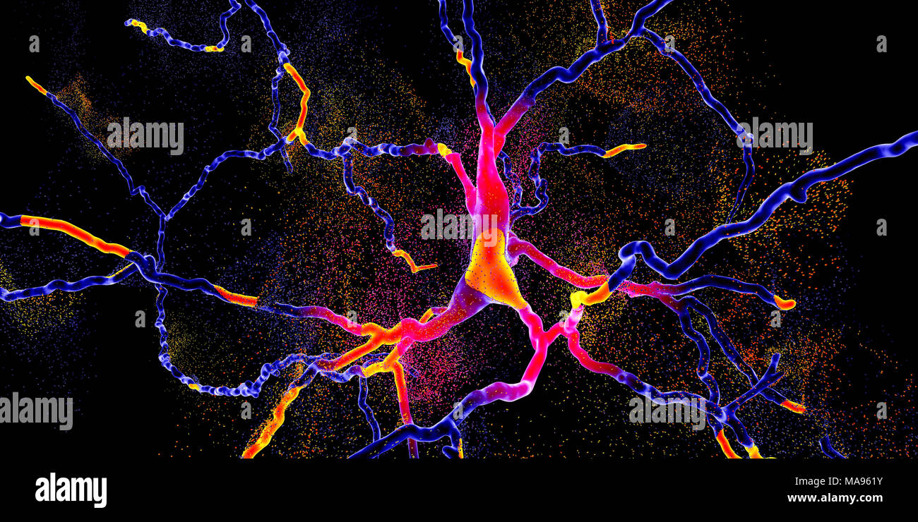 Conceptual illustration of the degeneration of a dopaminergic neuron ...
