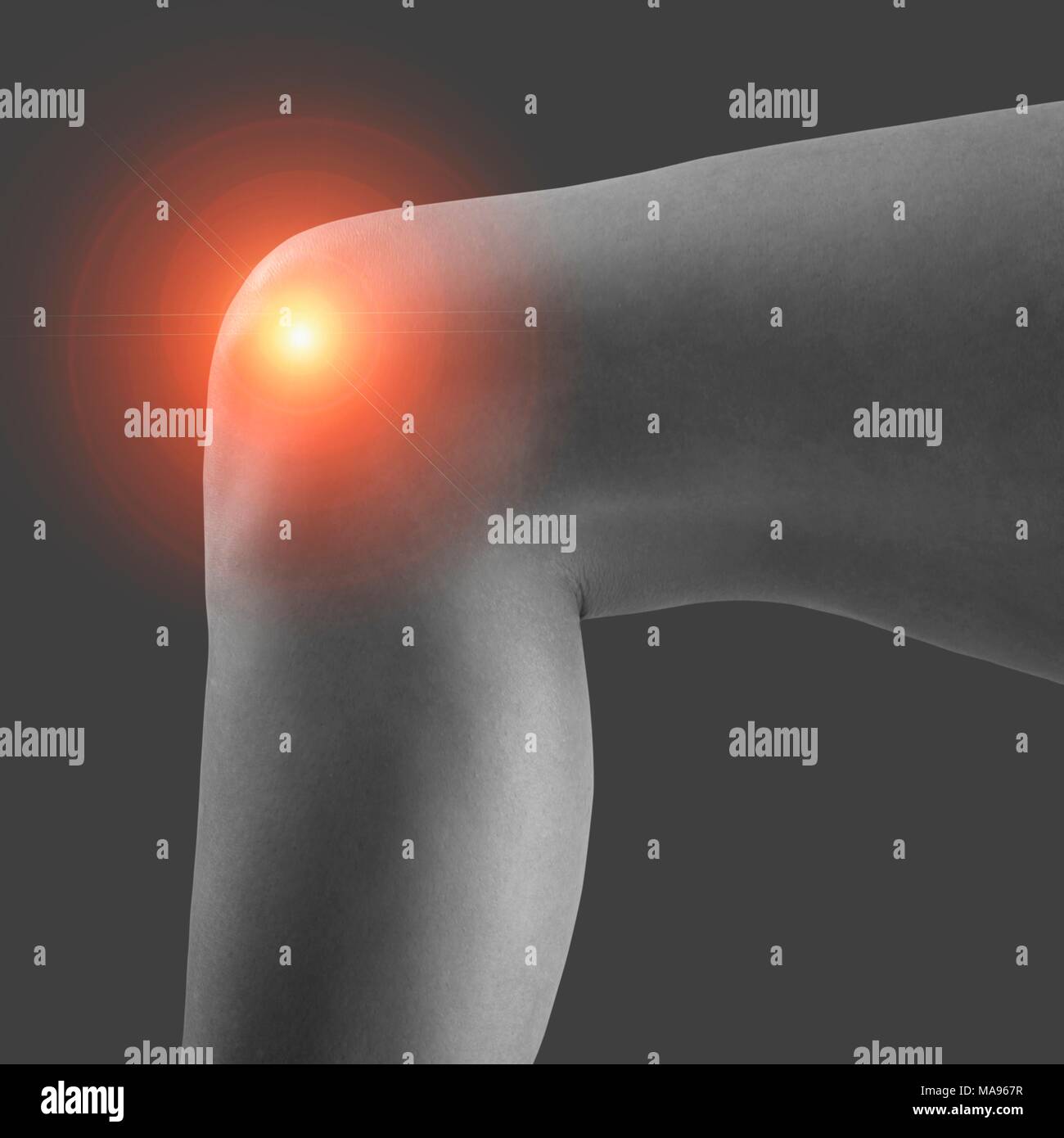 Knee pain, conceptual image Stock Photo - Alamy