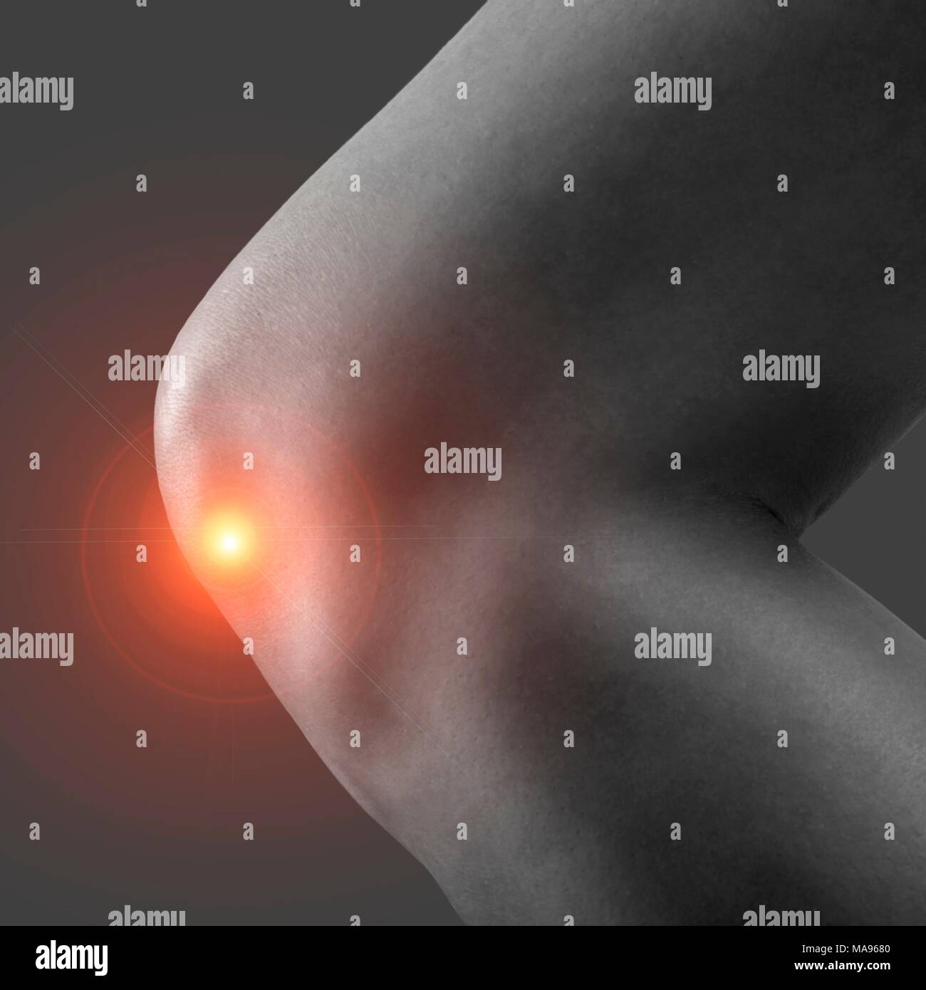 Knee pain, conceptual image Stock Photo - Alamy