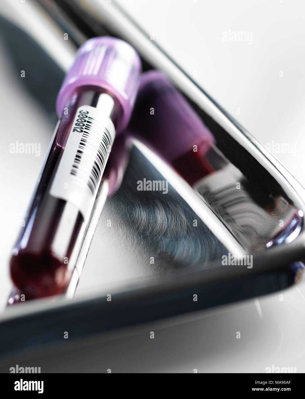 Awaiting lab hi-res stock photography and images - Alamy