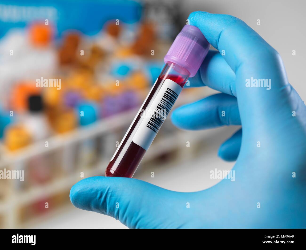 MODEL RELEASED. Technician holding a blood sample with a variety of ...