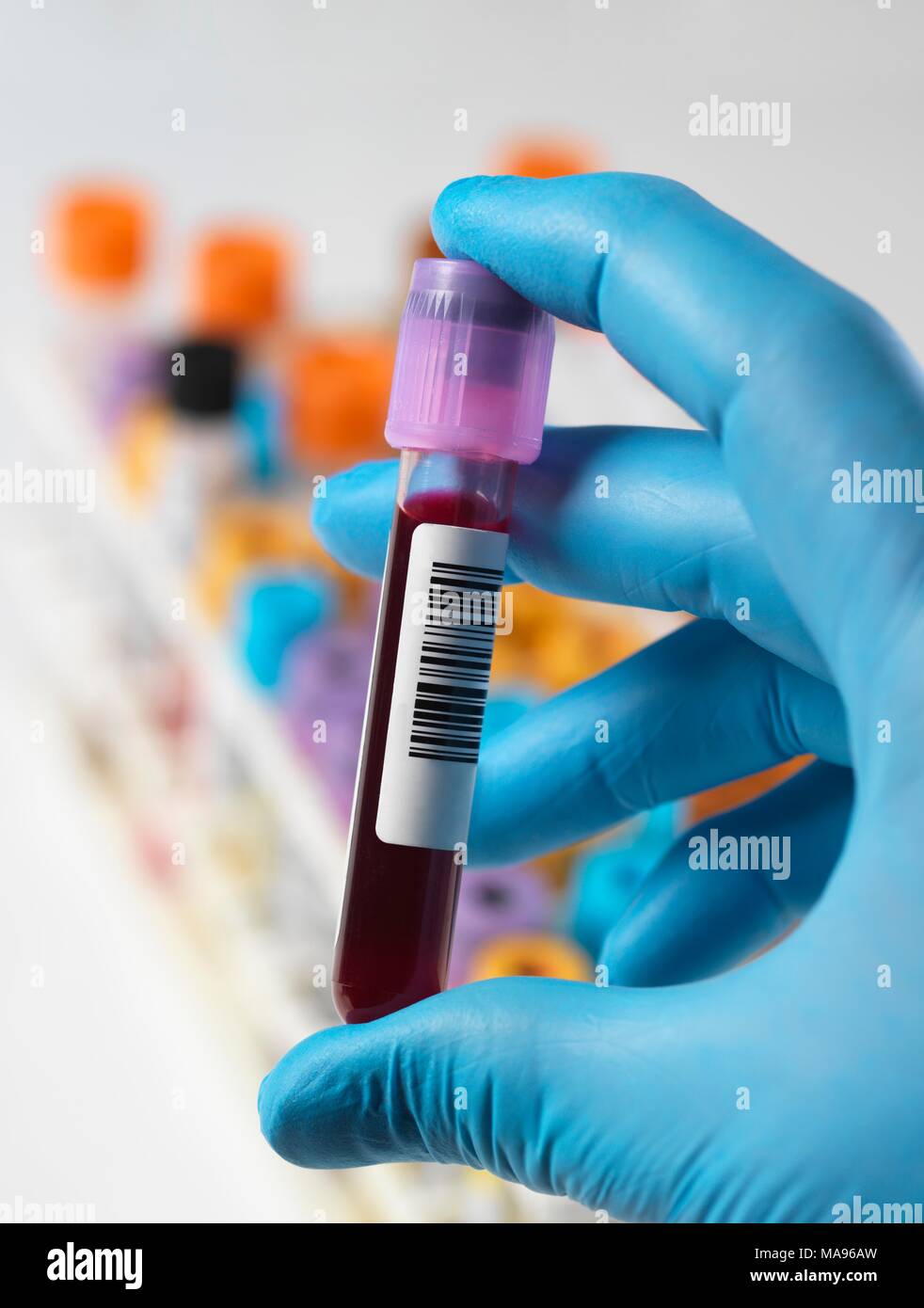 Gloved hand holding blood samples hi-res stock photography and images ...