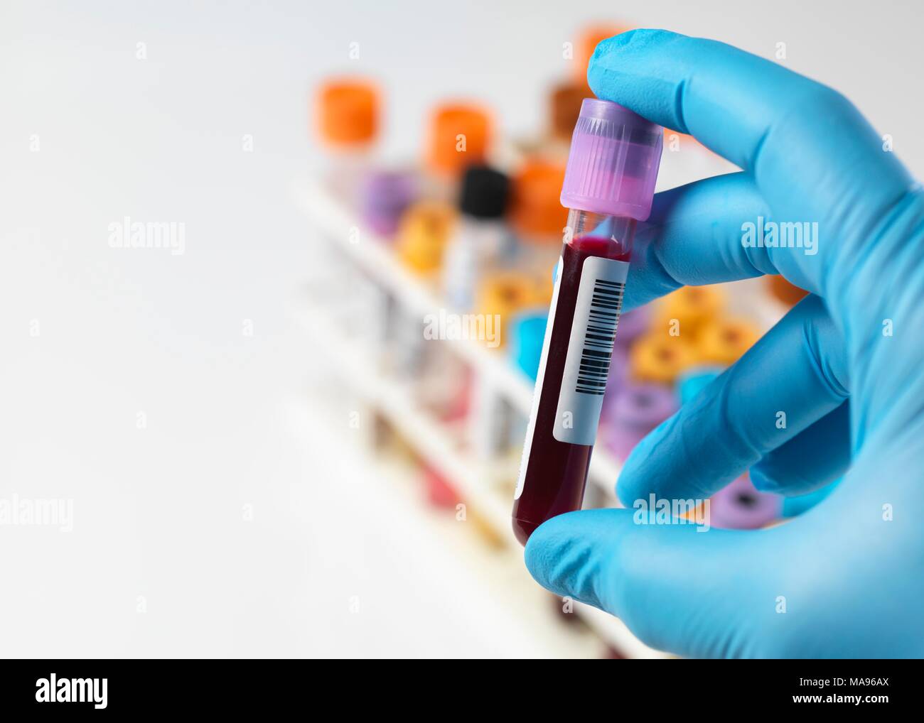 MODEL RELEASED. Technician holding a blood sample with a variety of ...
