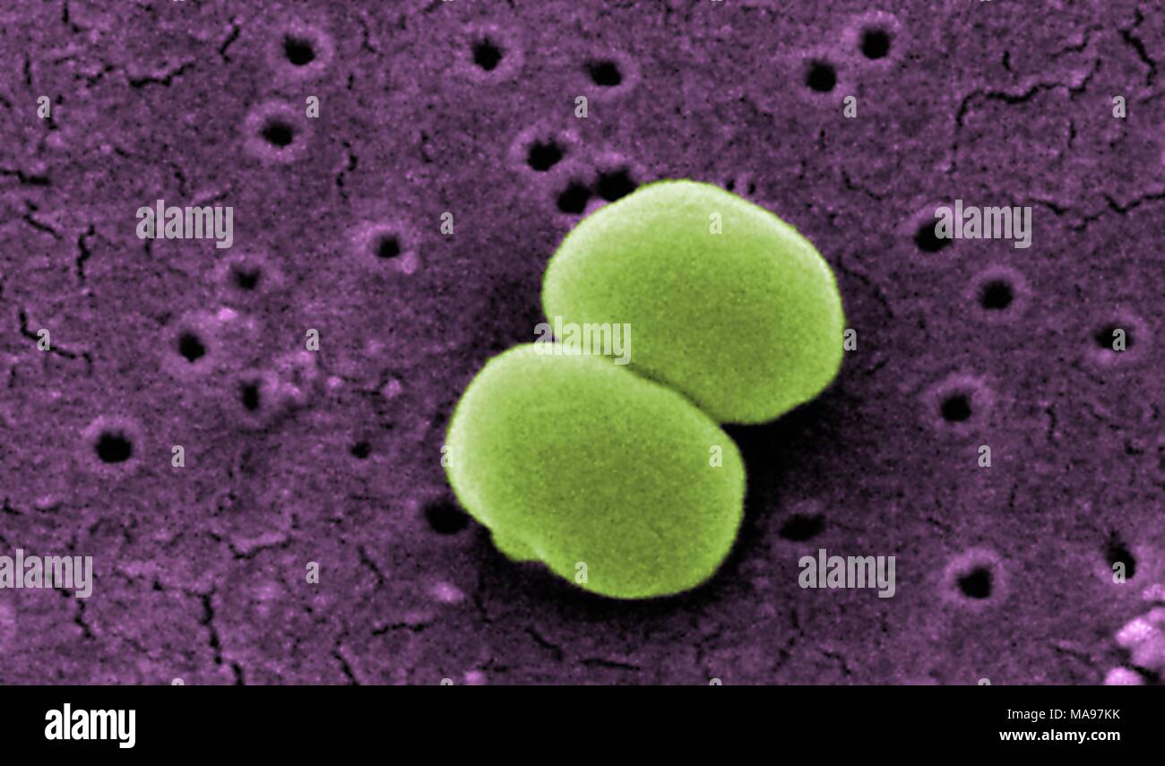 Two Staphylococcus epidermidis bacteria revealed in the scanning ...