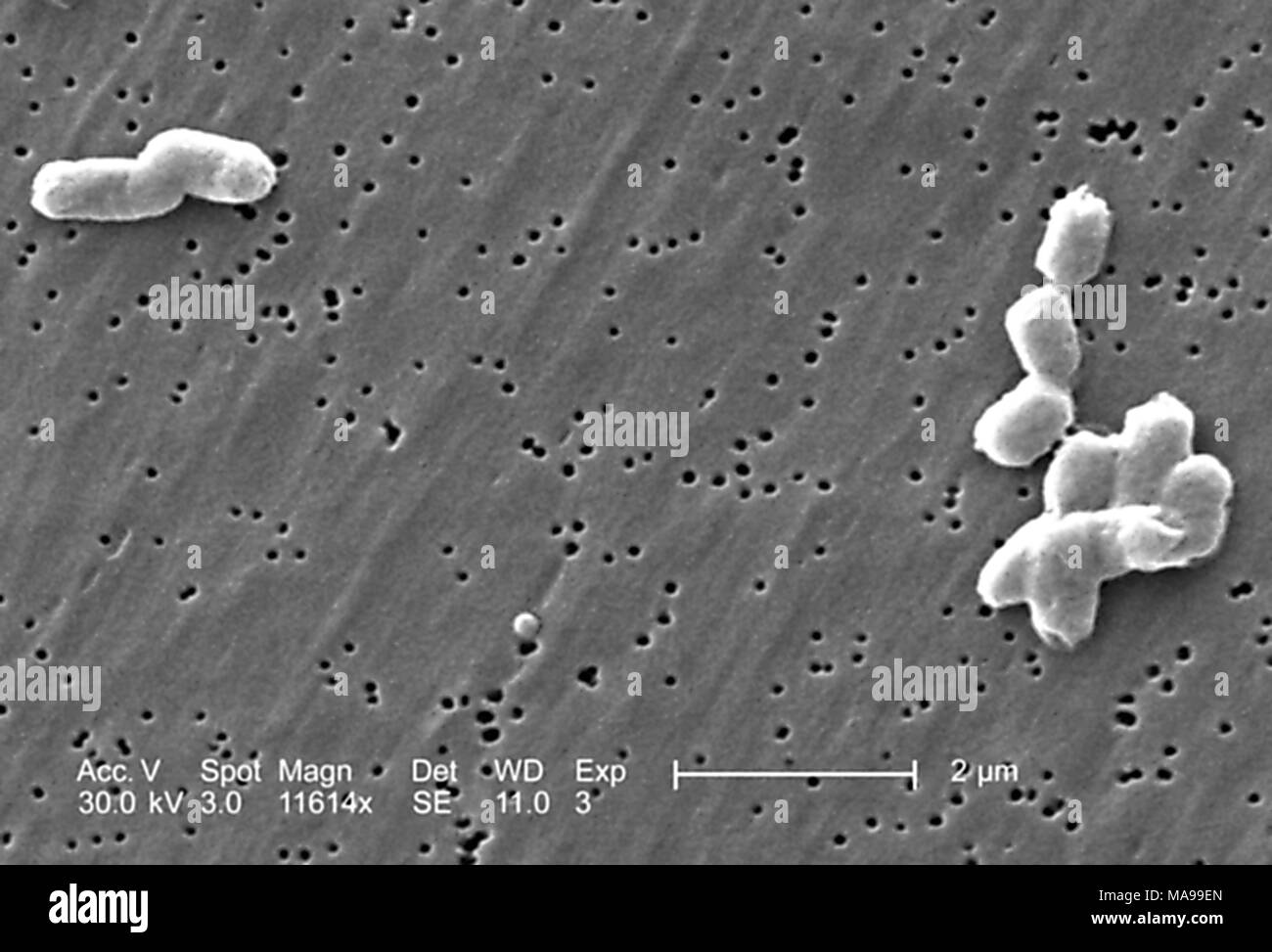 Salmonella bacteria microscopic Black and White Stock Photos & Images ...