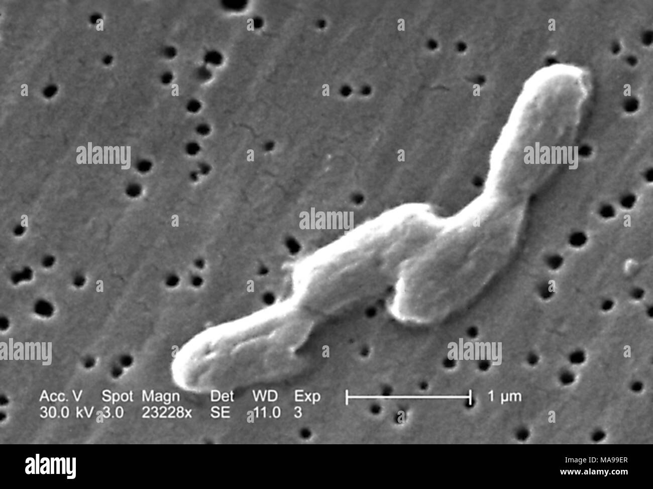 Four rod-shaped Gram-negative Salmonella infantis bacteria revealed in ...