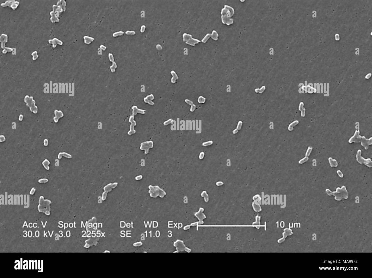 Rod-shaped Gram-negative Salmonella infantis bacteria revealed in the ...