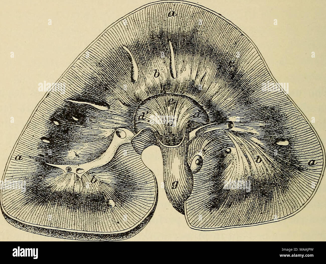 Infundibular In Kidney