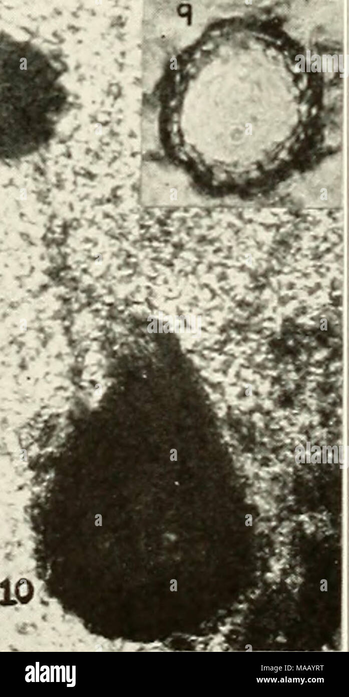 . Dutch elm disease, Graphium ulmi . Coremia and other stages of ...