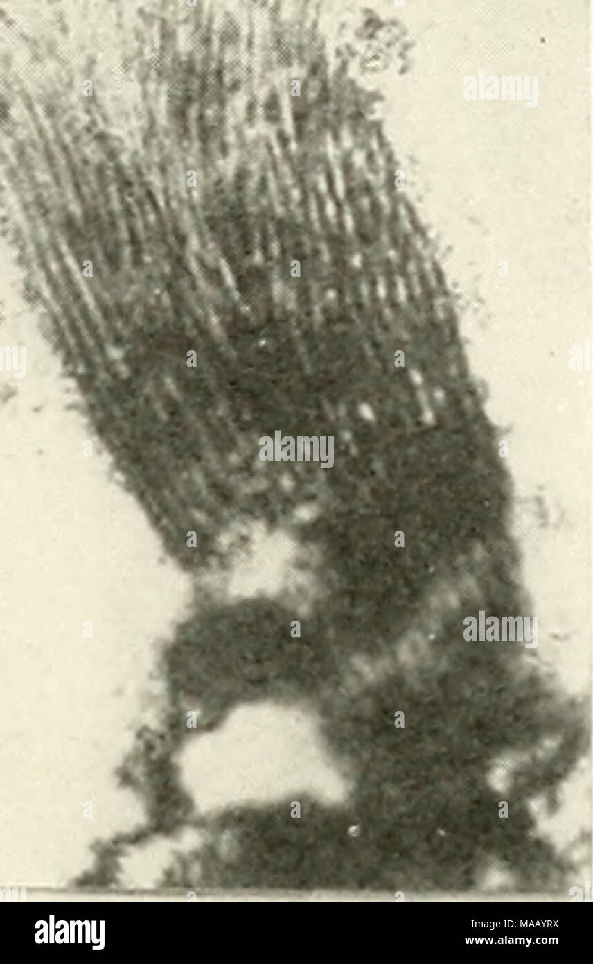 . Dutch elm disease, Graphium ulmi Stock Photo - Alamy