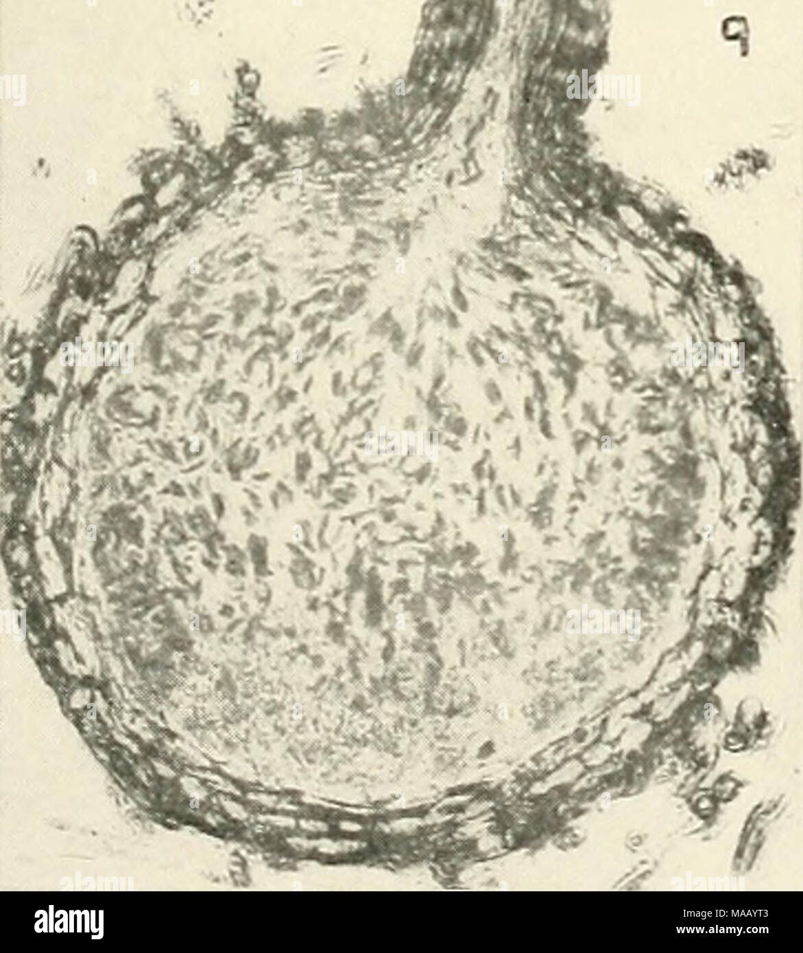 . Dutch elm disease, Graphium ulmi . / L Perithecial stage of ...
