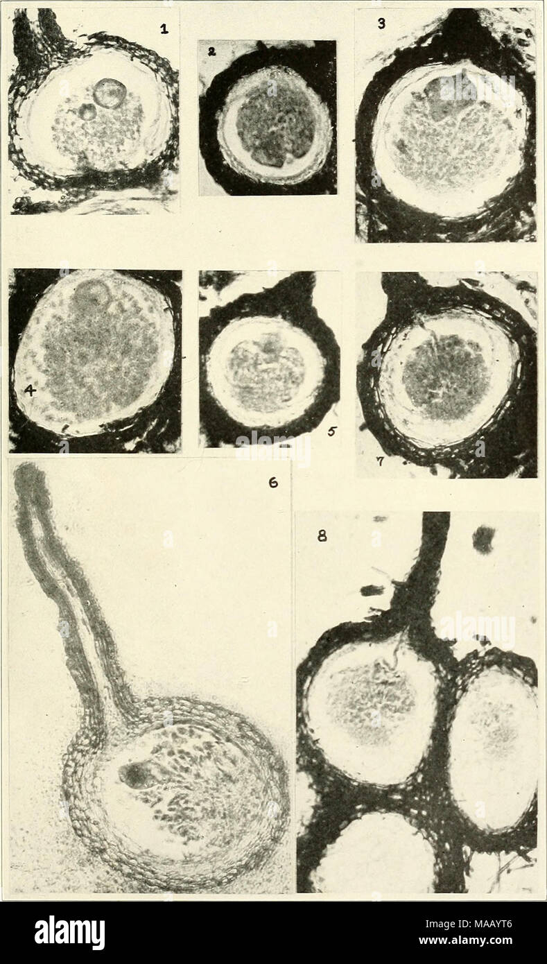 . Dutch elm disease, Graphium ulmi . Peculiar bodies in perithecia of ...