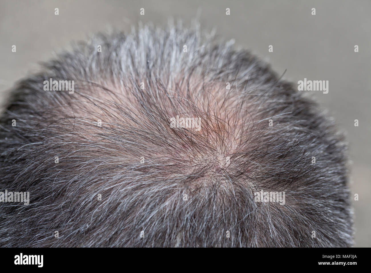 Middle aged losing hi-res stock photography and images - Alamy