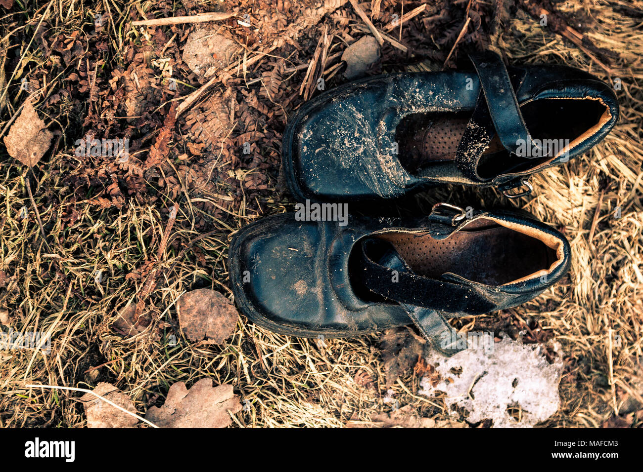 Burnt Foot High Resolution Stock Photography and Images - Alamy