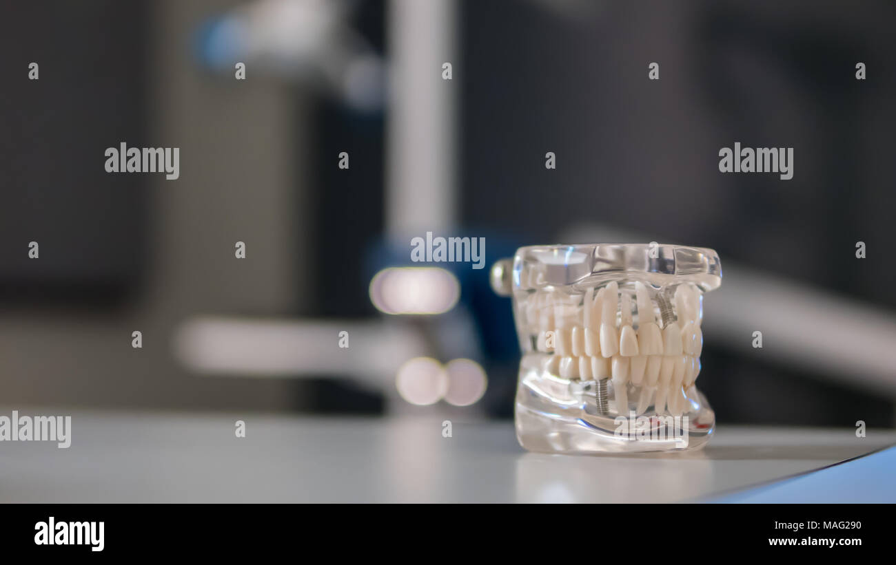 Close up, side view of an upper and lower jaw model used in dentistry ...