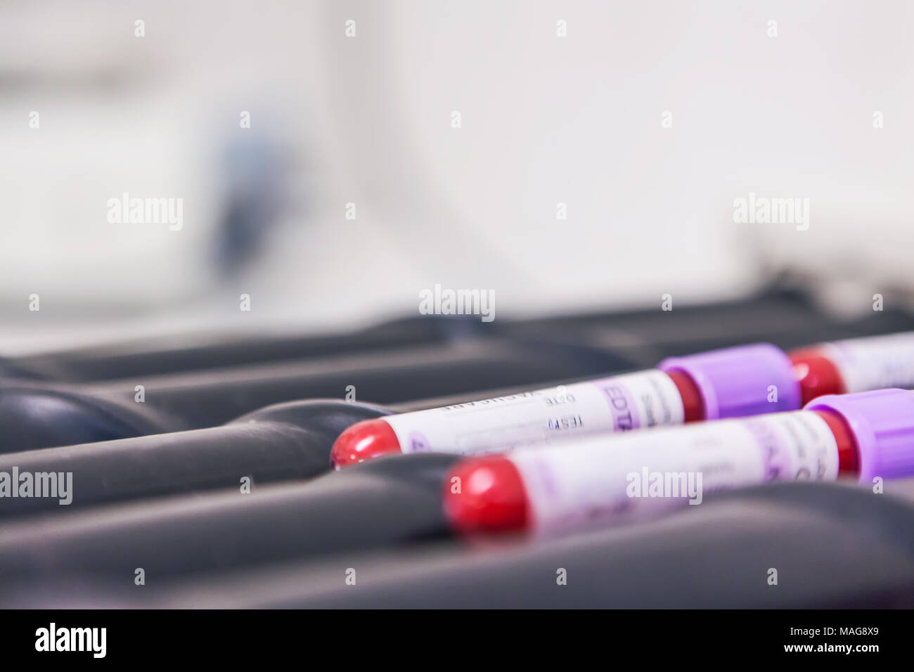 Clinical analysis tubes, usually used for blood tests Stock Photo - Alamy