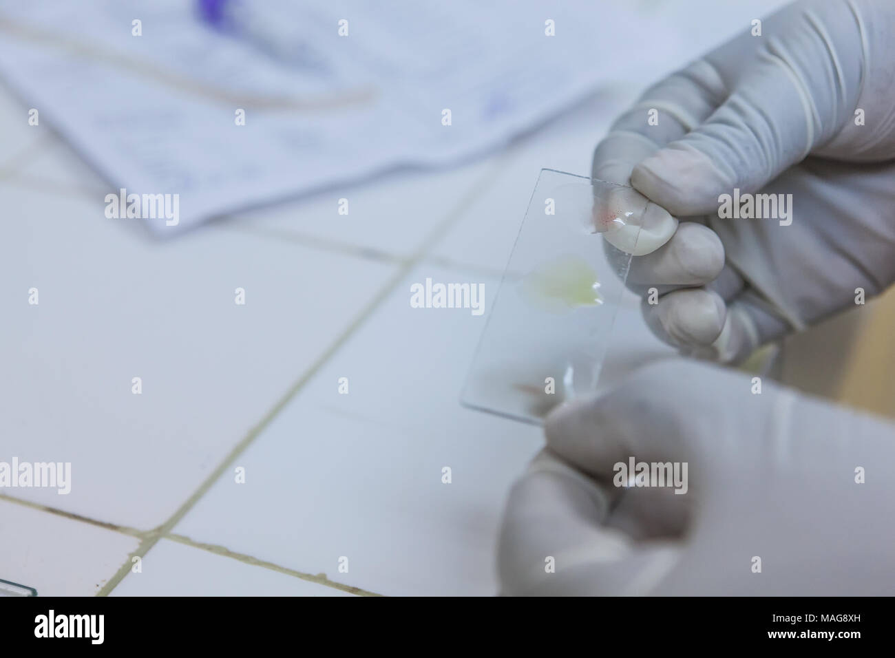 Hands of doctor holding blood test plates Stock Photo - Alamy