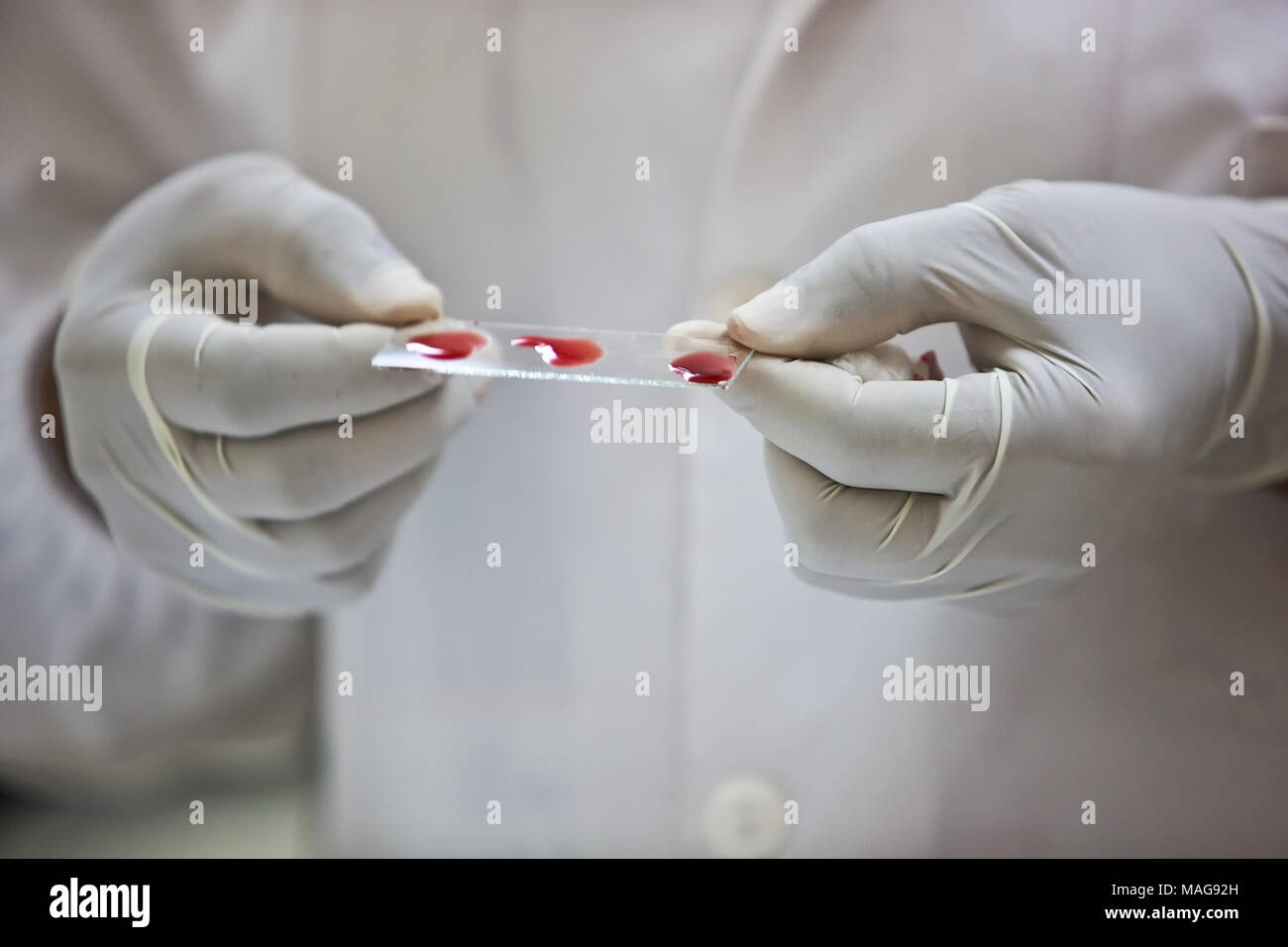 Doctor studying typhus hi-res stock photography and images - Alamy