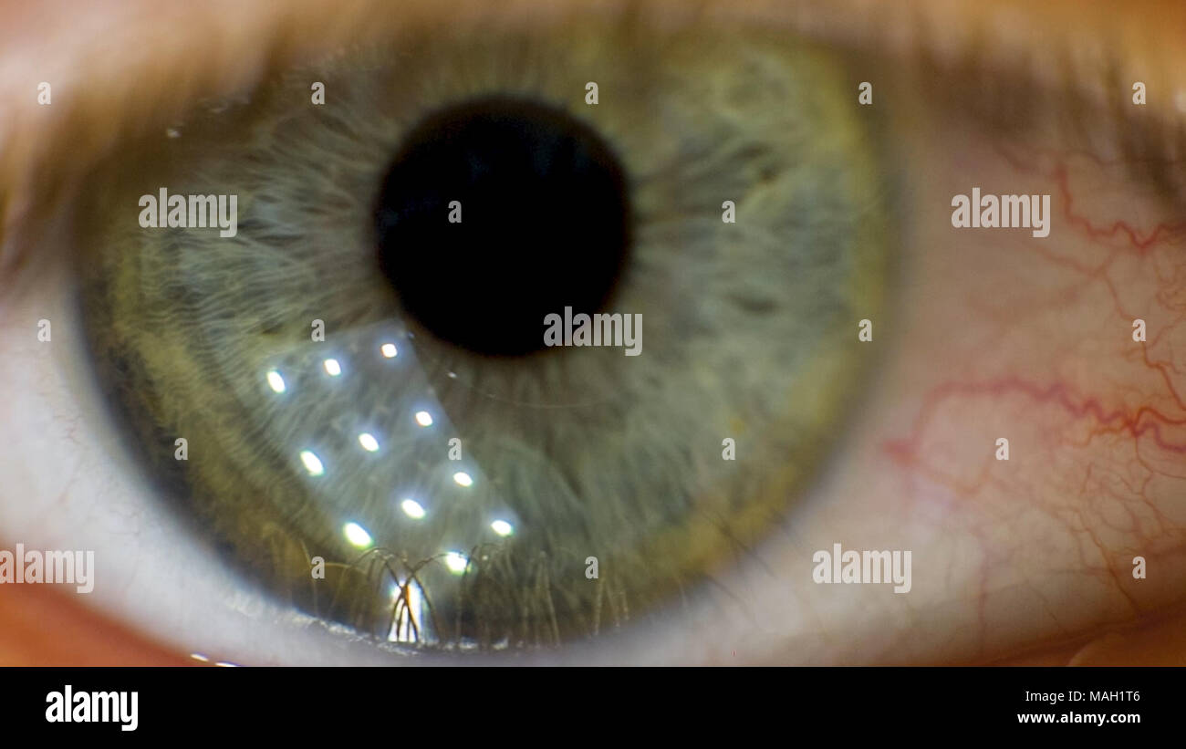 Human wide open blue eye hi-res stock photography and images - Alamy